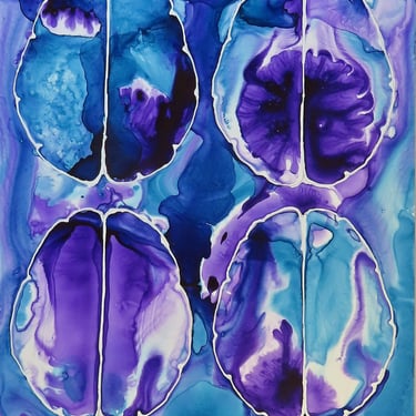 Purple and Blue Brain Scan - Neuroscience Art - Ink | Artologica ...