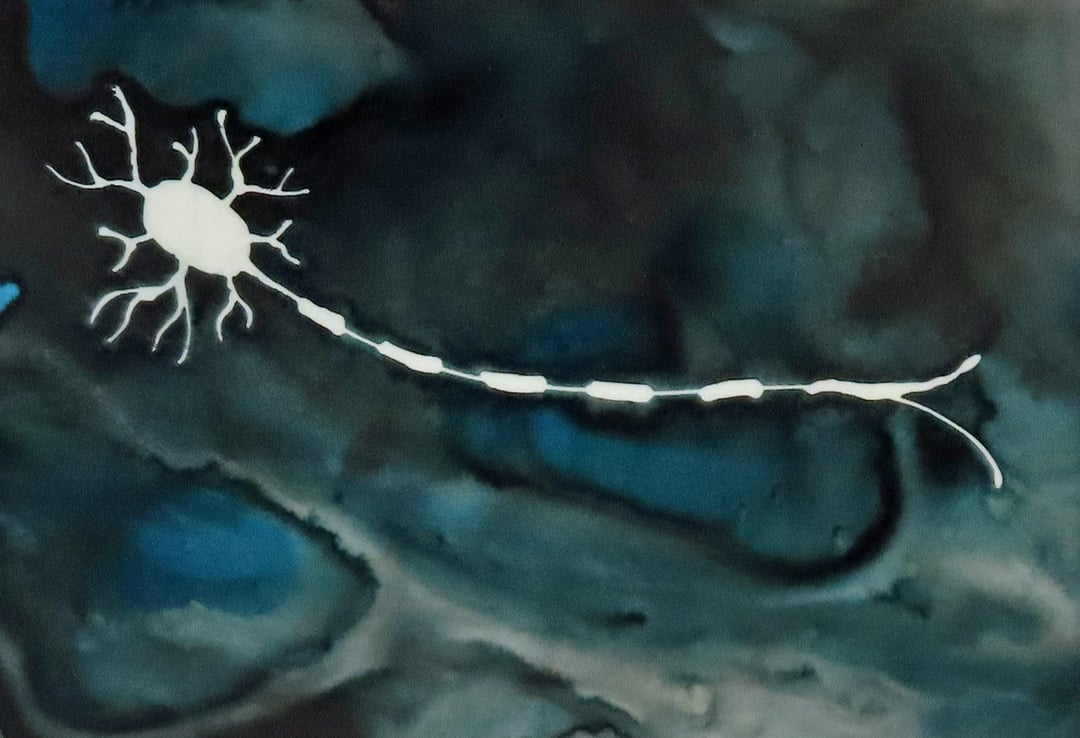 Motor Neuron 12 - original ink painting of brain cell - | Artologica ...