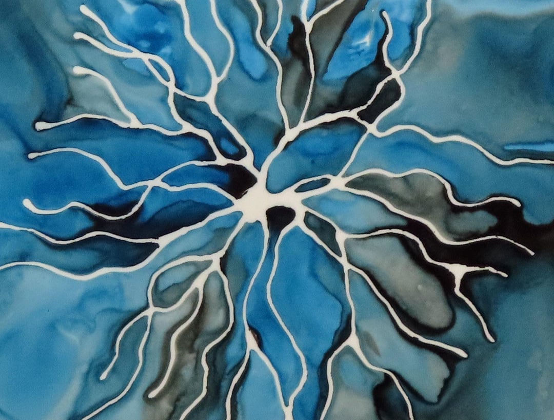 Retinal Neuron in Blue and Black - original ink painting | Artologica ...